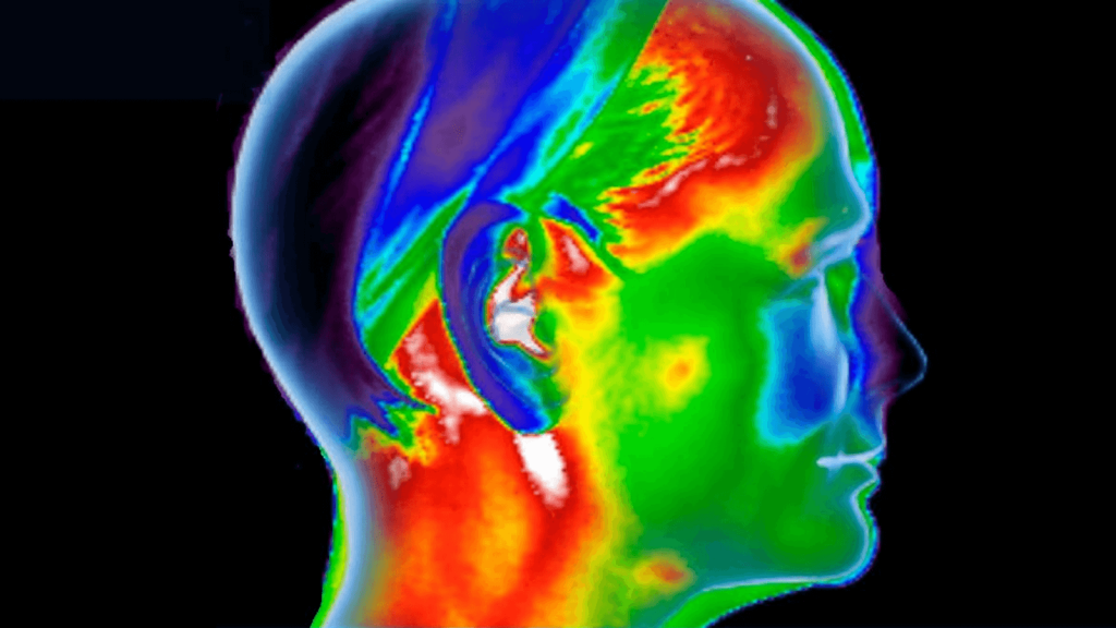 Termografia clínica: um avanço em métodos diagnósticos auxiliares ...