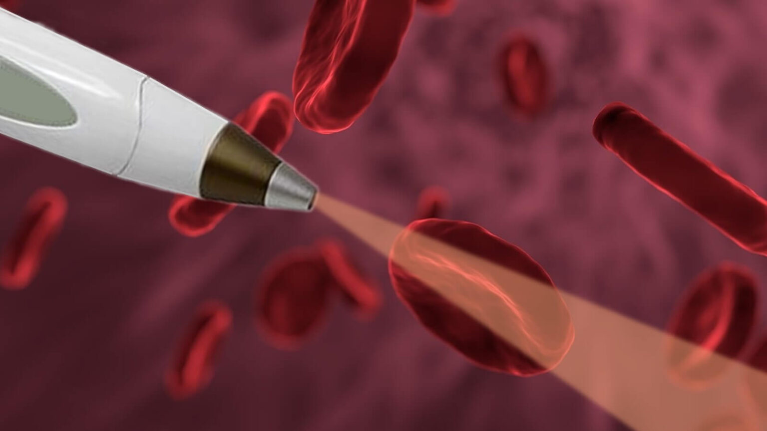 Benefícios da irradiação intravascular do sangue com laser de baixa ...